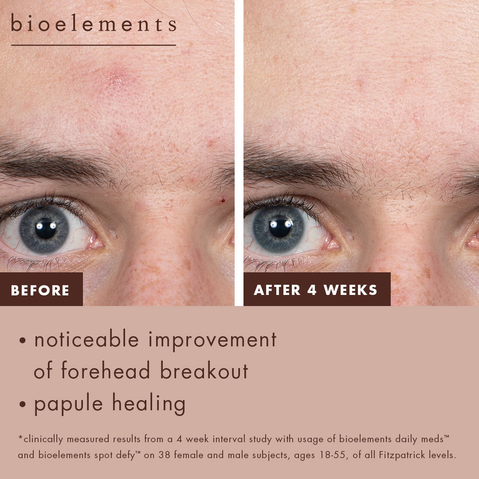 What's New – Bioelements