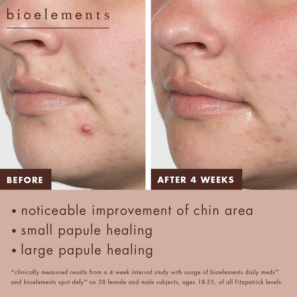 What's New – Bioelements