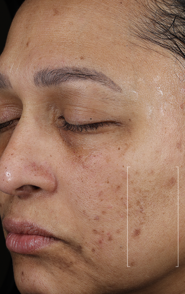 vc10 Collection – Bioelements