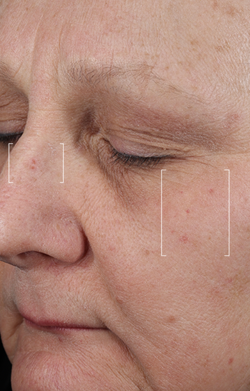 vc10 Collection – Bioelements